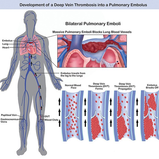 Mark M. Miller - Medical Illustration & Animation | Kansas City