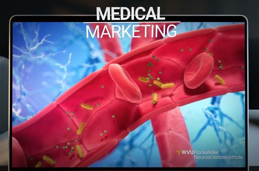 Intervoke Healthcare Animation Animation by Intervoke | Medical ...