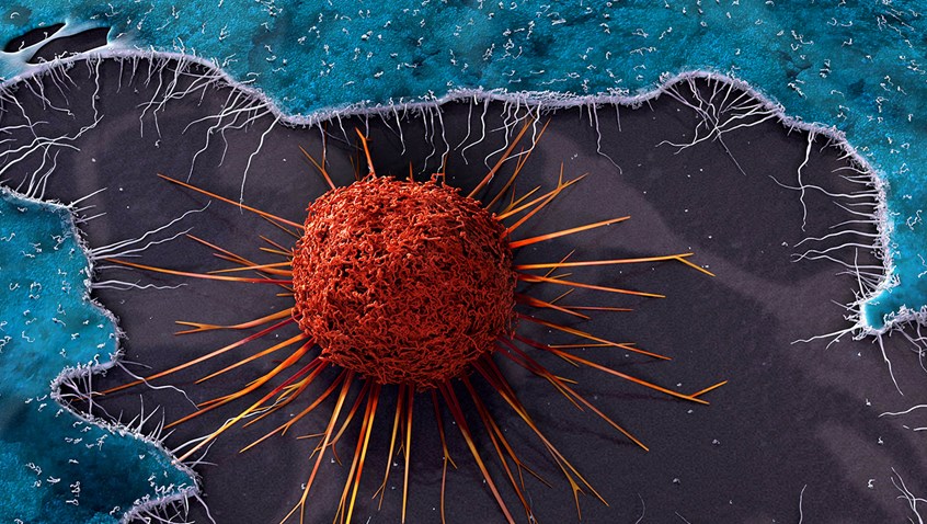 Cervical Cancer Cell Illustration by Lure Animations | Medical ...