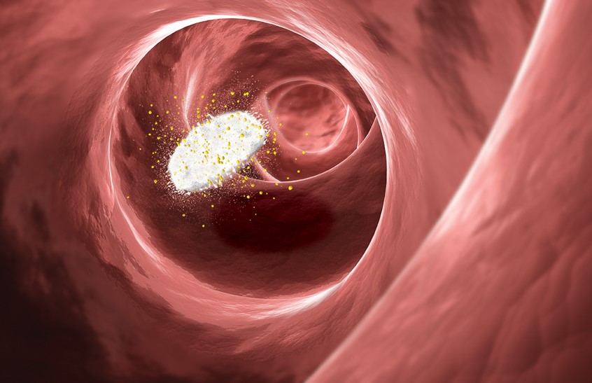Pill dissolve Illustration by Robert Lambiase | Medical Illustration ...