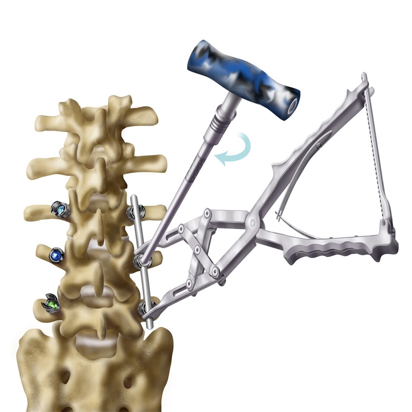 Illustration by IOLITE Creative | Medical Illustration & Animation