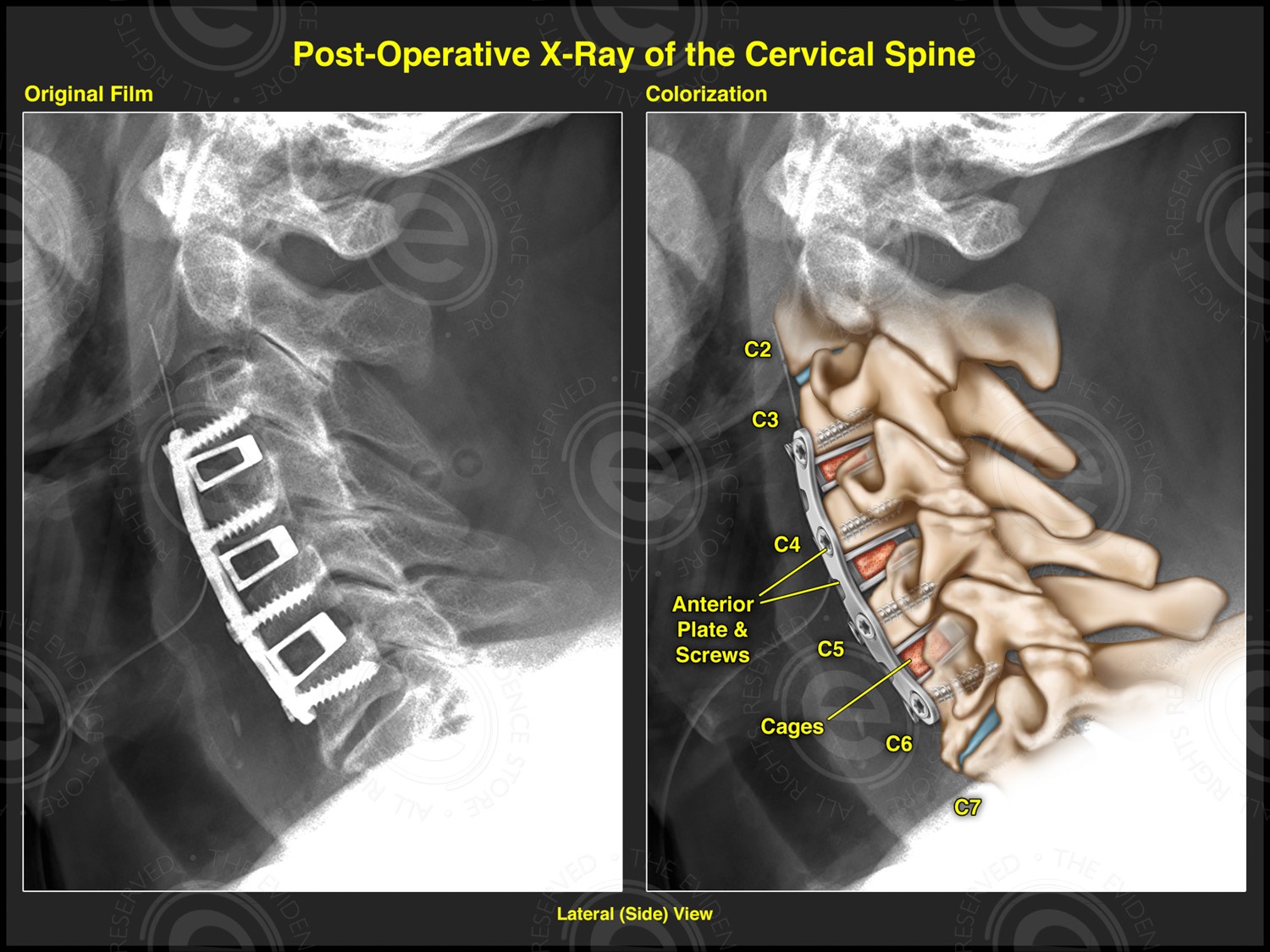 Medical Illustration and Animation :: Association of Medical Illustrators
