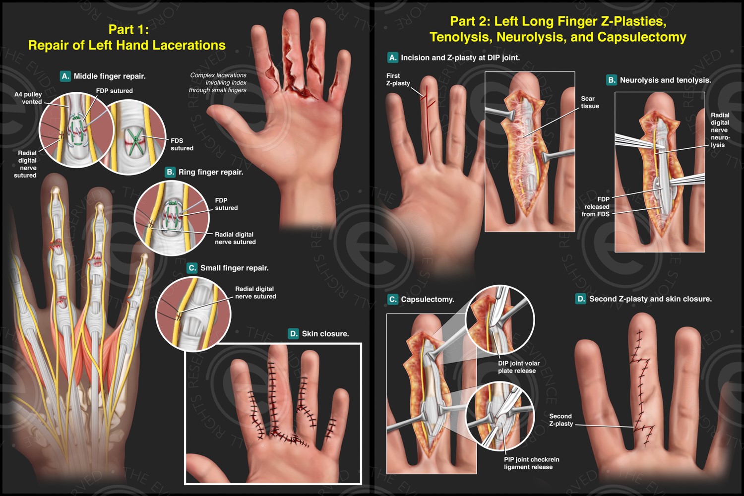 Medical Illustration and Animation :: Association of Medical Illustrators