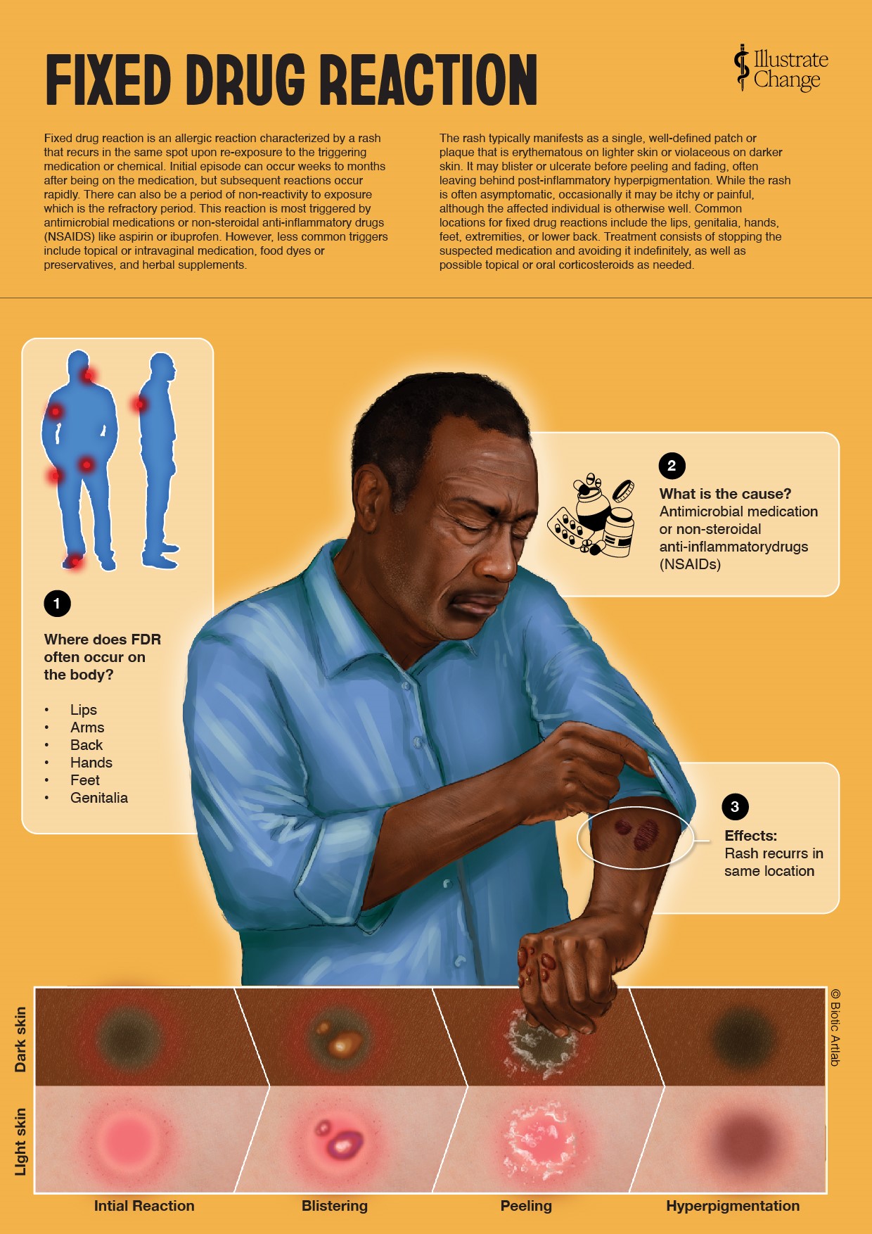 Search Results :: Medical Illustration and Animation