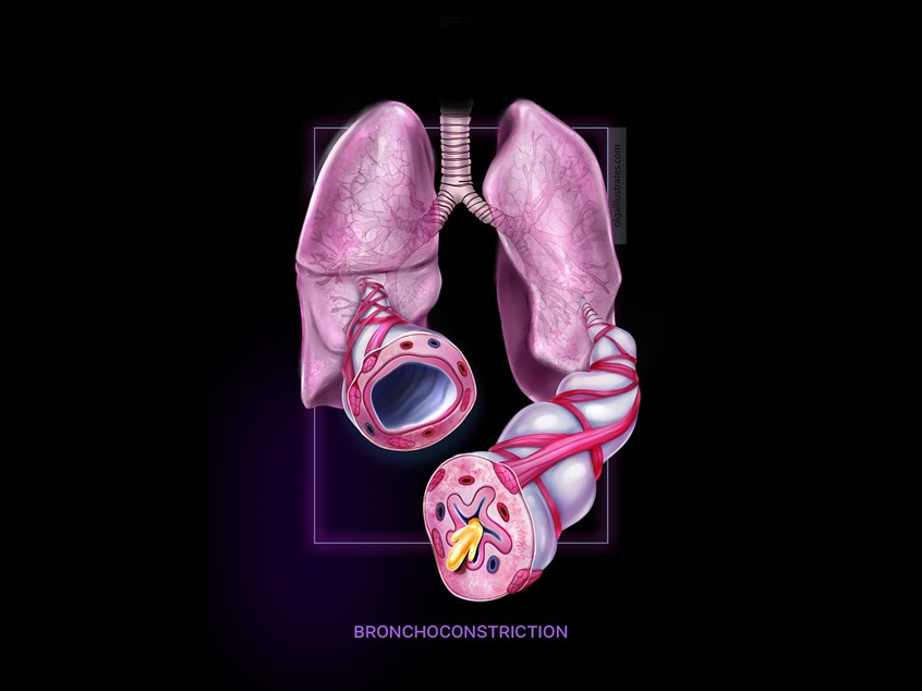 Bronchoconstriction Animation by Olga Kurkina | Medical Illustration ...