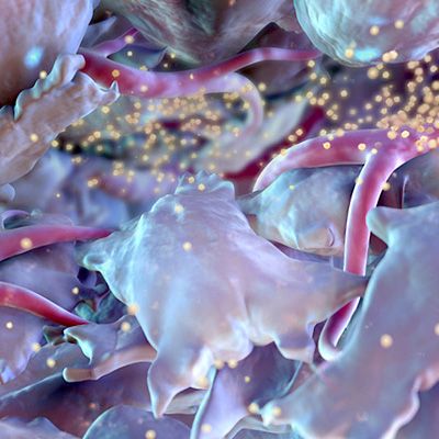 Illustration by Hybrid Medical Animation | Medical Illustration & Animation