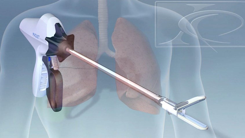 Maquet RFR Device Animation by KO Studios | Medical Illustration ...