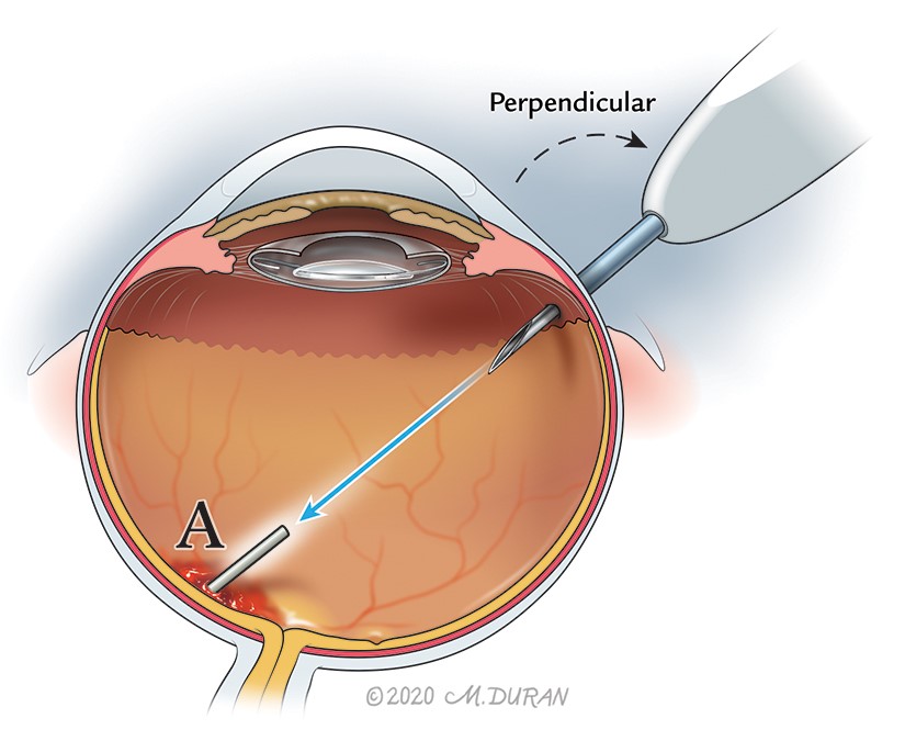 Search Results :: Medical Illustration and Animation
