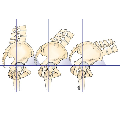 Illustration by Kimberly Battista | Medical Illustration & Animation