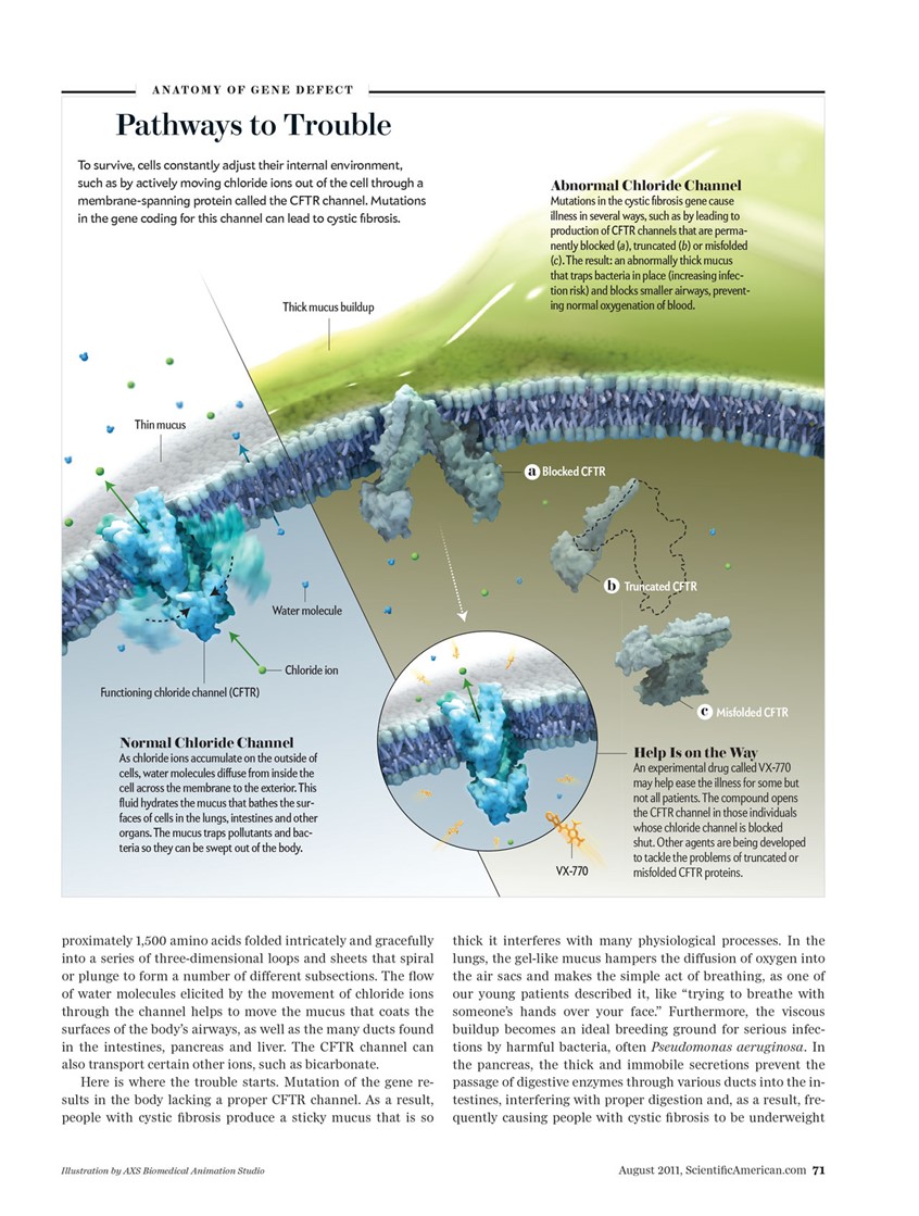 Cystic Fibrosis (CF) Scientific Illustration Illustration by AXS Studio ...
