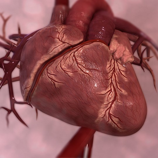 Brain Aneurysm Overview Animation Animation by Silverback | Medical ...