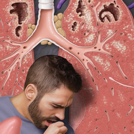 Mark M. Miller - Medical Illustration & Animation | Kansas City