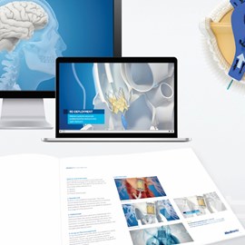 Illustration by Hybrid Medical Animation | Medical Illustration & Animation
