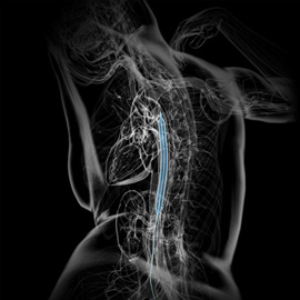 Fistula Illustration by Bryan Christie Design, LLC | Medical ...