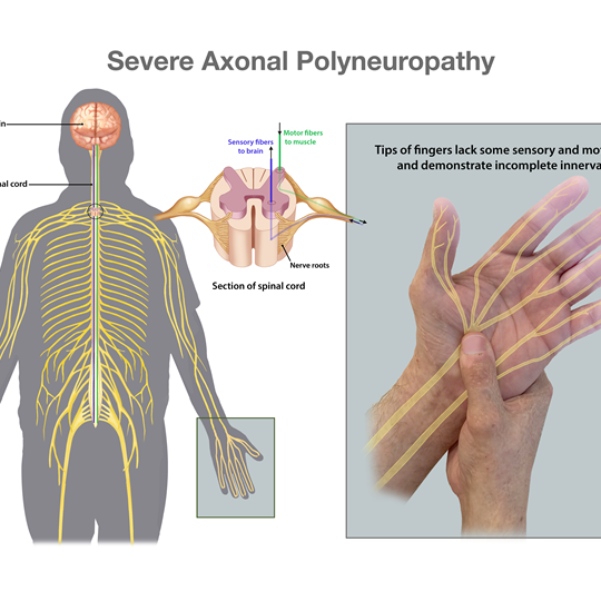 Medical Illustration and Animation :: Association of Medical Illustrators