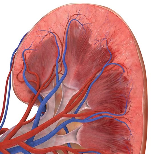 Renal Medullary Carcinoma Illustration by Adam Questell | Medical ...