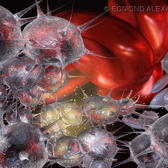 Blood Clot Illustration by Edmond Alexander | Medical Illustration ...