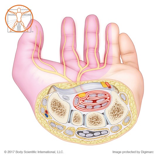 Shoulder Bursitis Illustration by Body Scientific | Medical ...